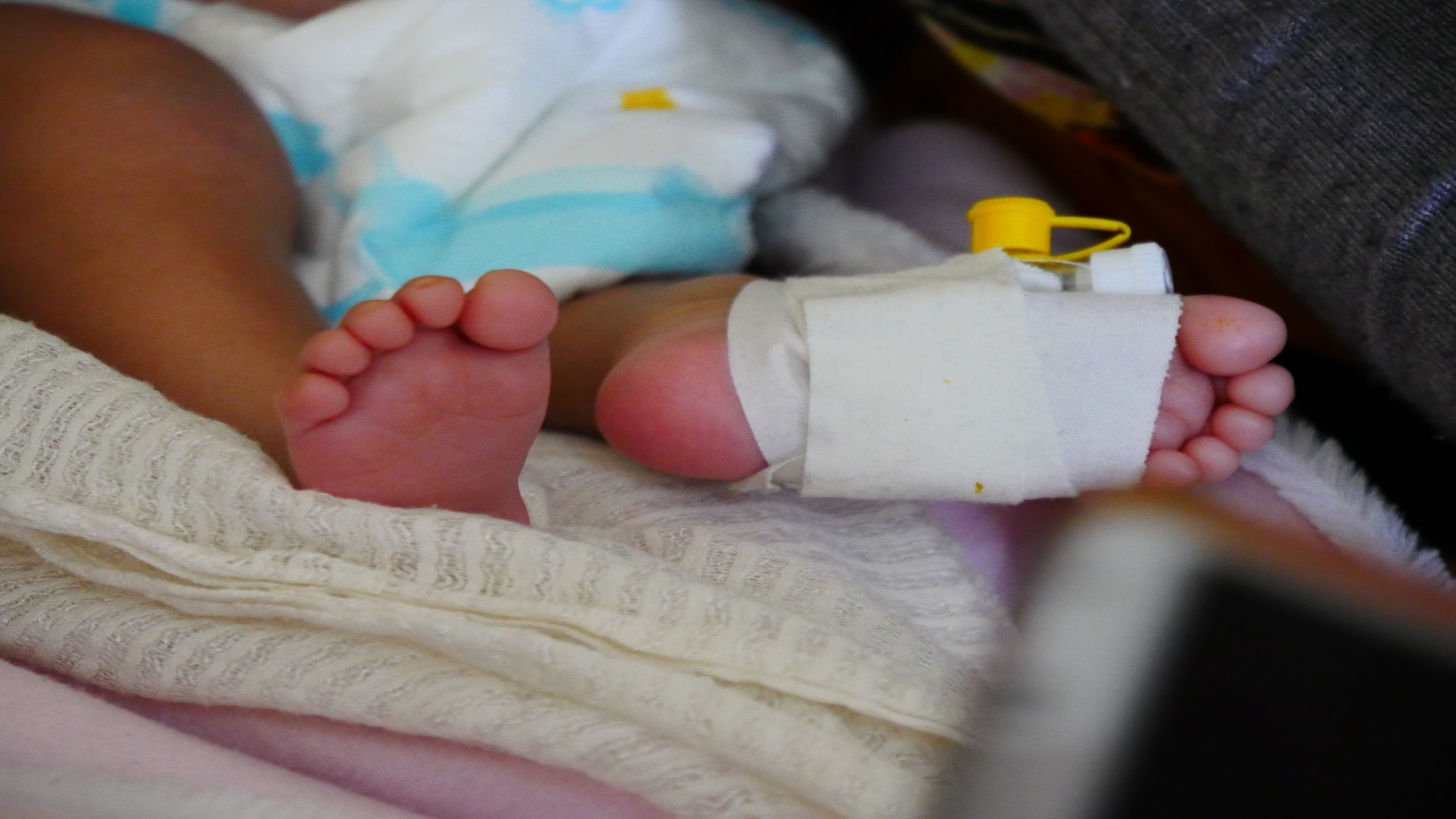 Birth Defects Research Article - ReachAnother Foundation